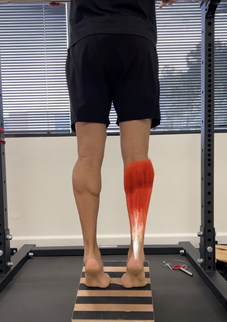 Assessing Achilles Tendinopathy - TRIPP